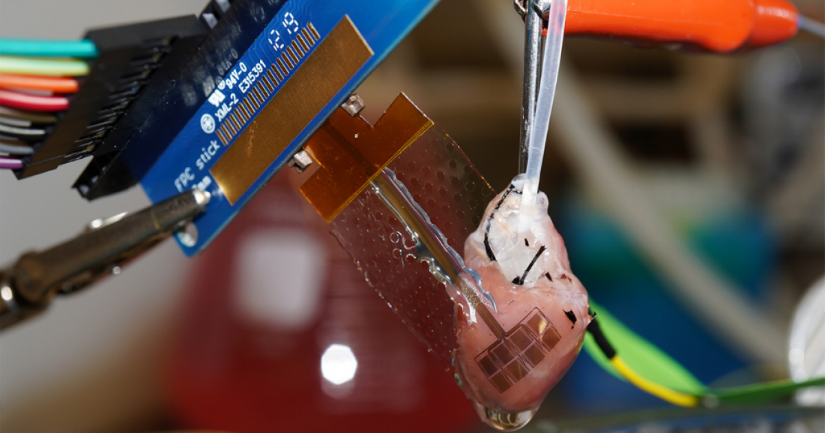 New self-assembly method creates bioelectronics from microscopic ...