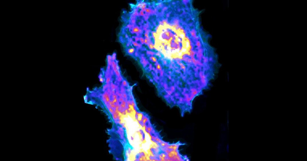 How Jun Huang seeks the cure for cancer at the molecular level ...