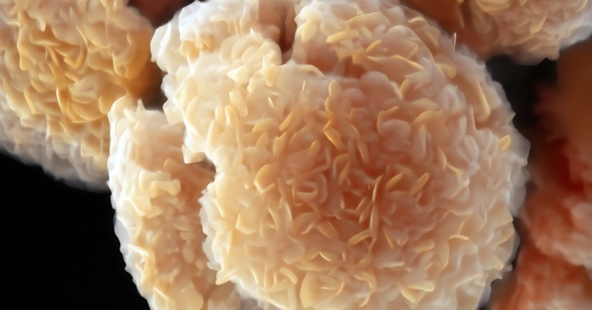 Research reinvents MXene synthesis | Pritzker School of Molecular ...